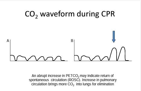 Waveform Capnography